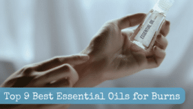 Top 9 Best Essential Oils for Burns - Backdoor Survival