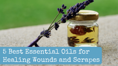 10 Best Essential Oils for Healing Wounds and Scrapes - Backdoor Survival