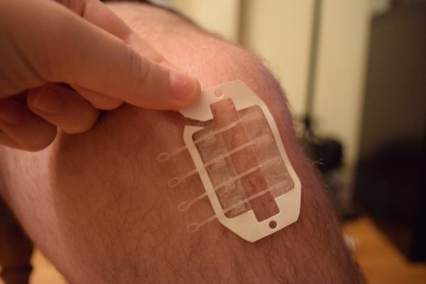 ZipStitch Review: The Perfect Tool for the Right Injury - Backdoor Survival