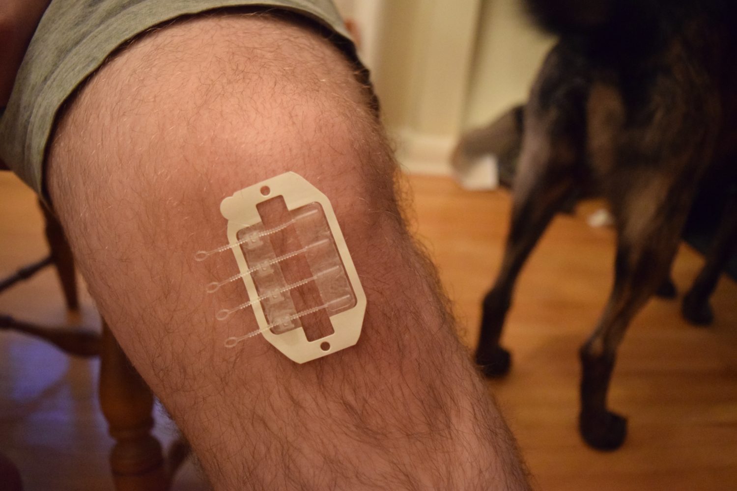 ZipStitch Review: The Perfect Tool for the Right Injury - Backdoor Survival